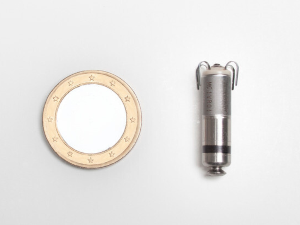 Leadless Pacemaker Implantation in Singapore - Orchard Heart Specialist